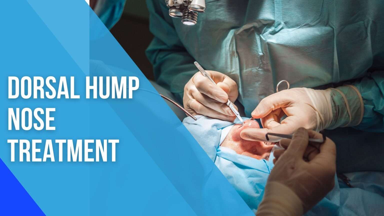 Nasal Hump Removal Surgery : Surgical Techniques & Patient Management